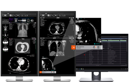 Cardiovascular AI Solutions | Aidoc