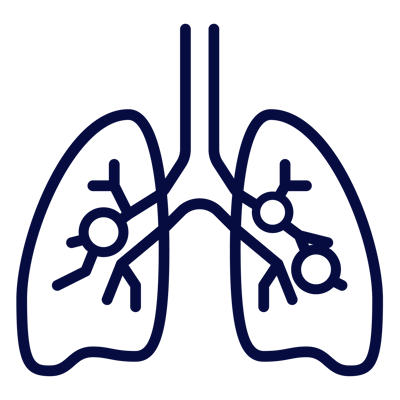 CT AI Algorithms | Aidoc